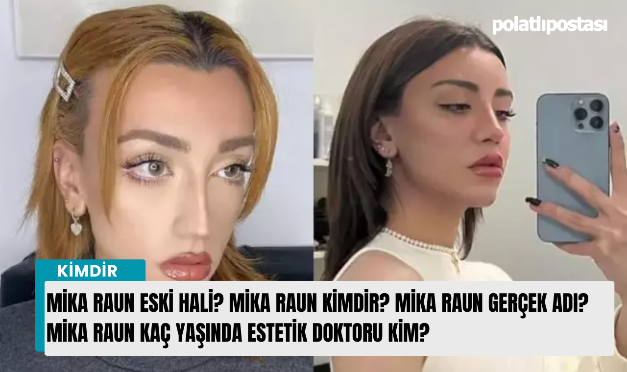 Mika Raun eski hali? Mika Raun kimdir? Mika Raun Gerçek Adı? Mika Raun ...